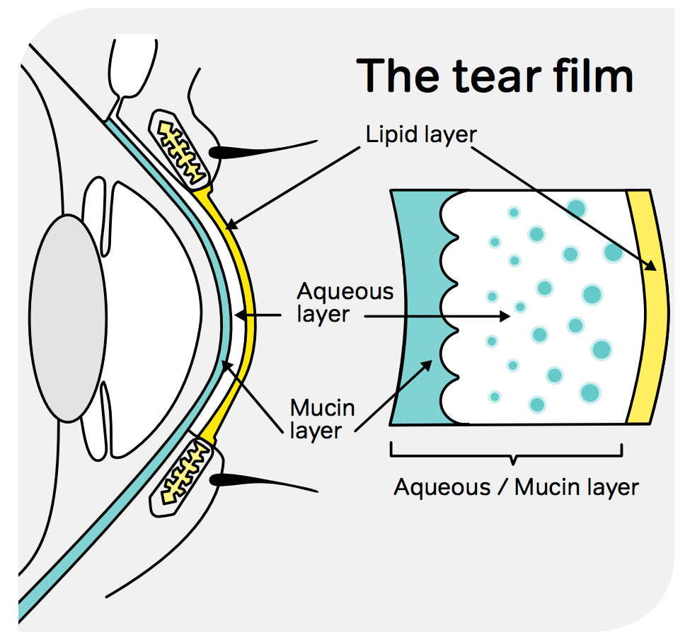 Dry eye - Tahmina Pearsall